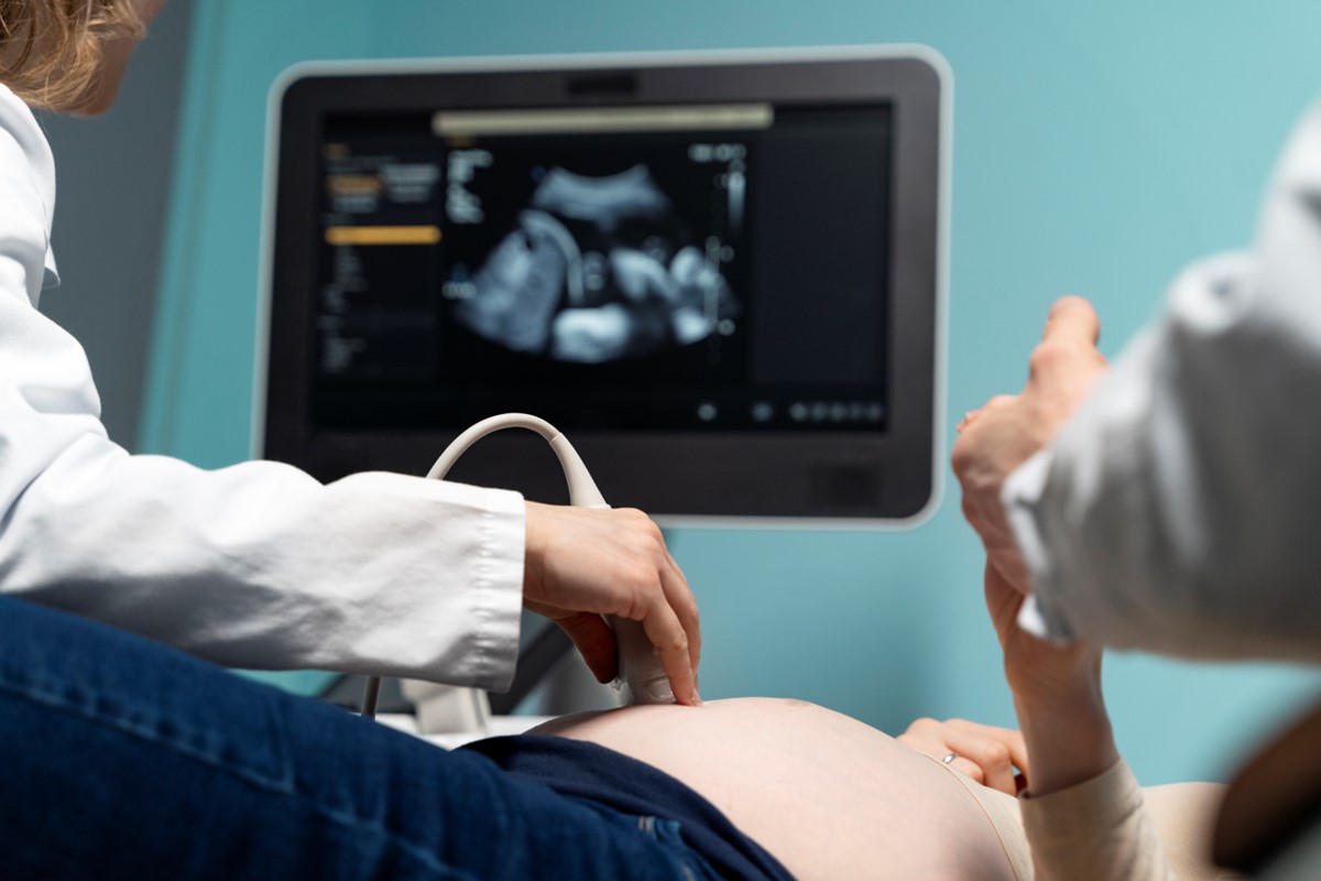 Color Doppler Ultrasound in Pregnancy: Preparation and Expectations ...