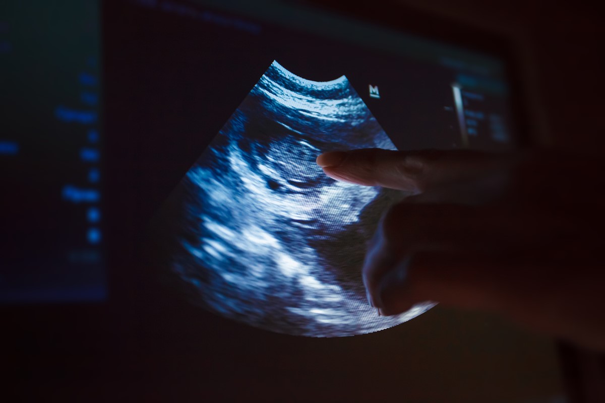 Prenatal Viability Scan: Assessing Fetal Health - maitridiagnosticspanvel